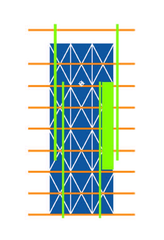 Operating Room Ceiling Design